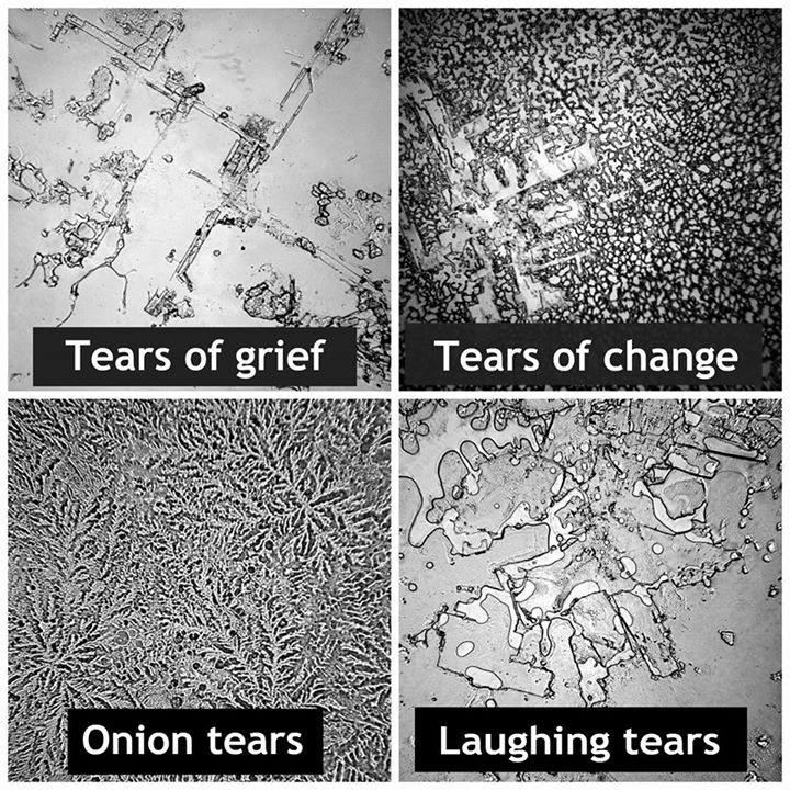 Human Tears Under a Microscope