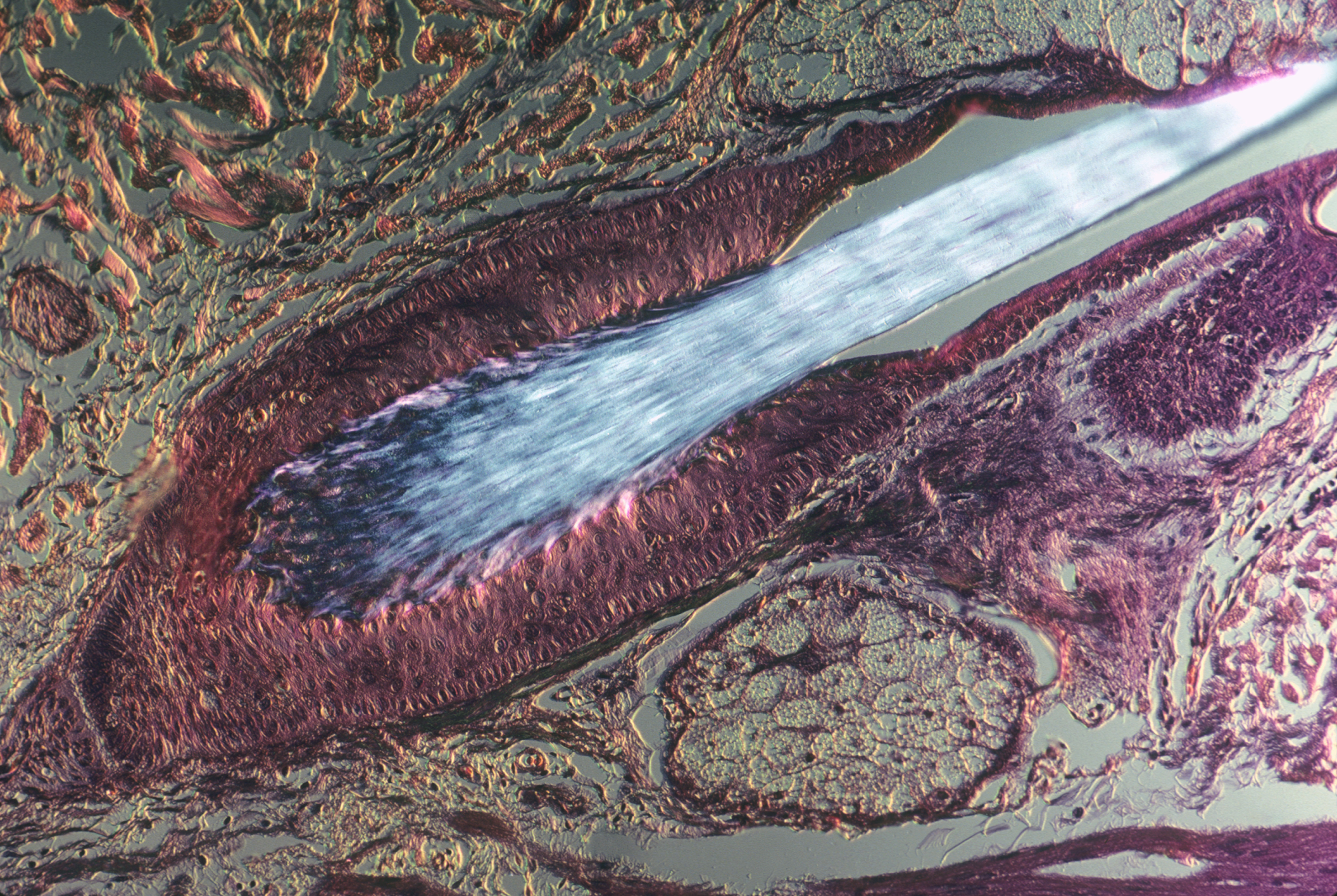 Lab-Grown Skin With Hair Will Illuminate Treatments For Skin Conditions