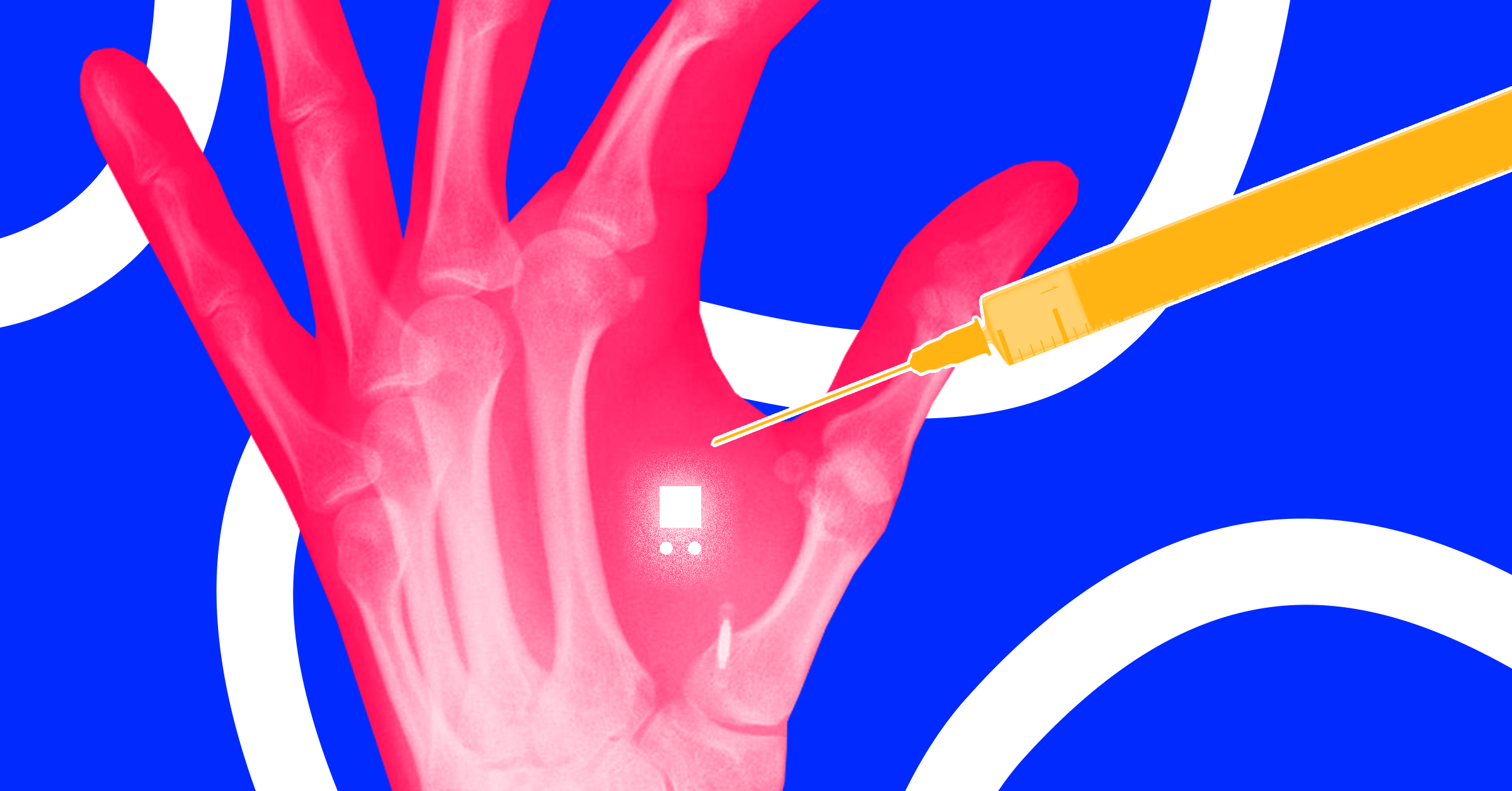 The Danger of Sweden's Microchip Implant Trend | Futurism