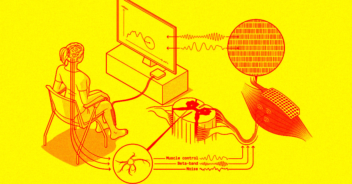 Scientists Working on Third Arm You Control Using Your Brain