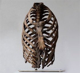 12 Amazing & Unsettling Historical Medical Images