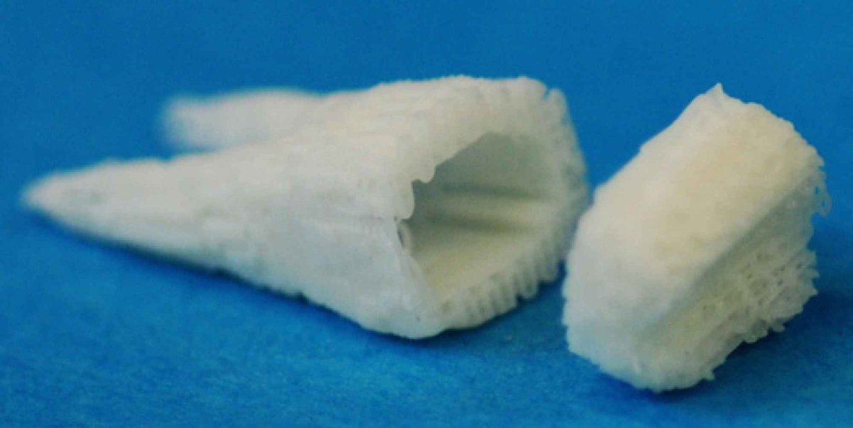 Stem-Cell Dental Implants Grow New Teeth Right In Your Mouth