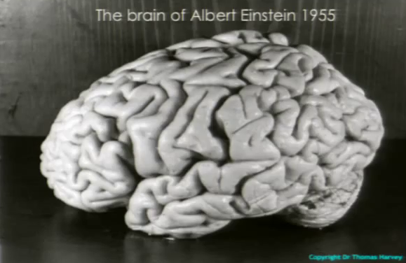 The Myth of Einstein's Brain and How it Differs from the Norm