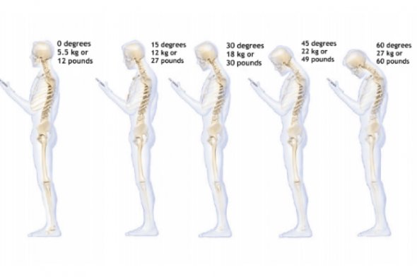 Study Shows What Cell Phone Use Does To Our Necks