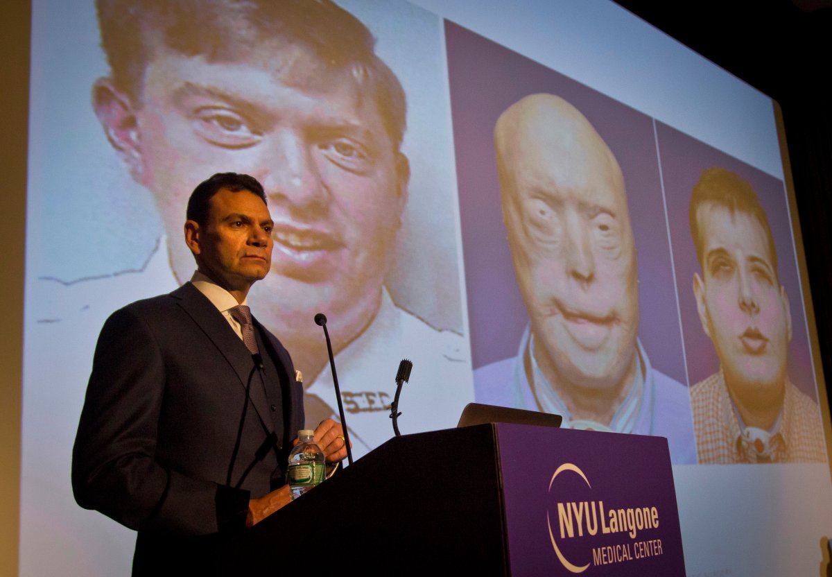 Medical Breakthrough: Firefighter Receives World's Most Extensive Face ...