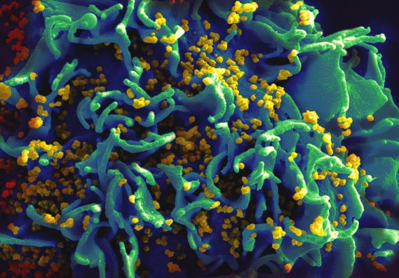 HIV Can Mutate to Evade Attempts To Modify It With CRISPR Gene Editing