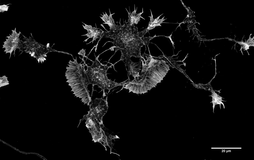 Researchers Can Now Repair Severed Neuron Connections Using Lasers