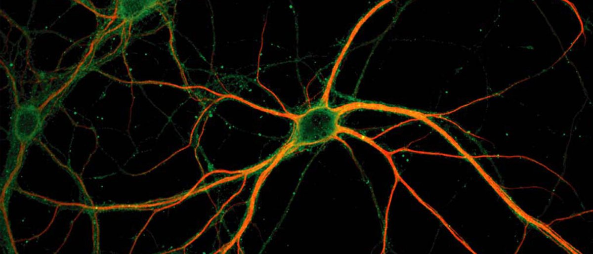 Scientists Claim That They Have Discovered How to "Delete" Unwanted ...