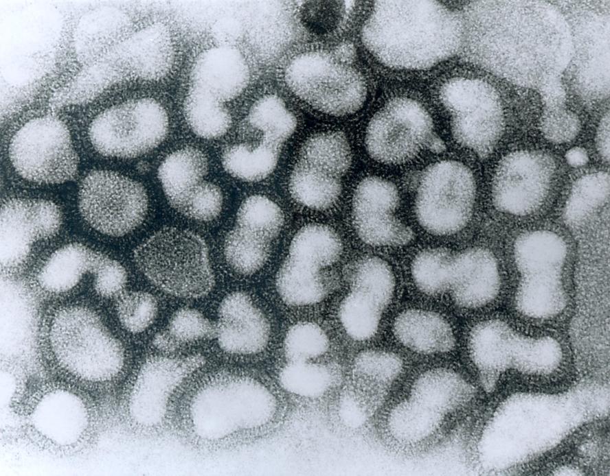 New Biosensor Rapidly Detects Multiple Viruses, and is 80% Cheaper Than ...