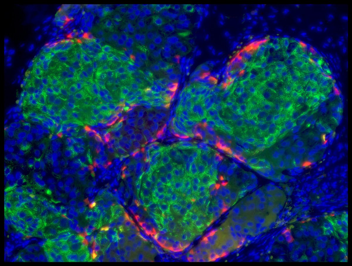 Human Beta Cells Successfully Eliminate Diabetes in Mice