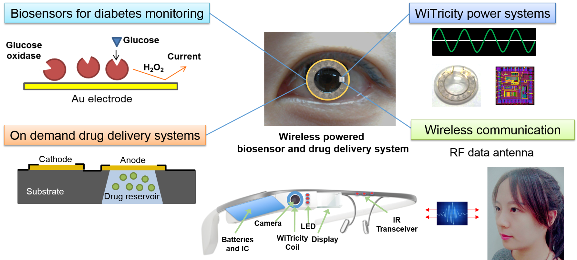 Scientists Created Smart Contacts That Can Monitor and Treat Diabetes