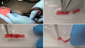 Self-Healing Textile: Welcome to the Age of Clothes That Can Heal ...
