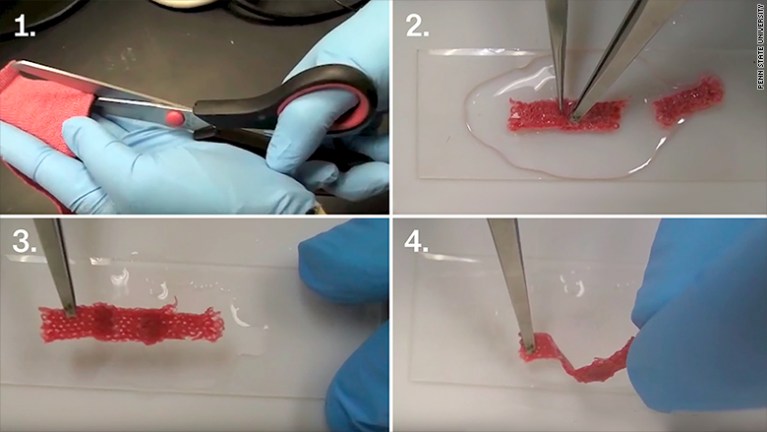 Self-Healing Textile: Welcome to the Age of Clothes That Can Heal ...