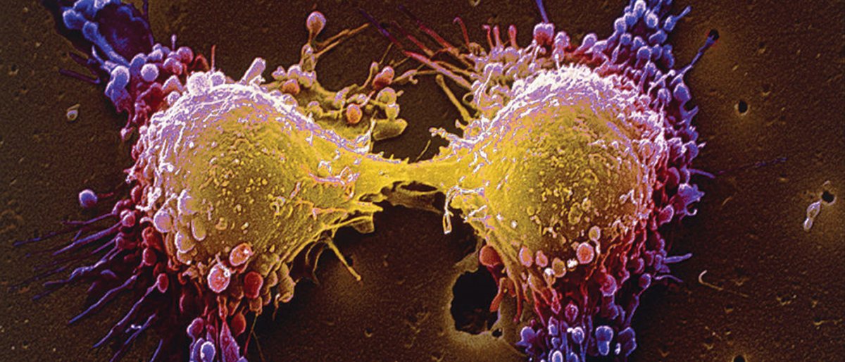 Cutting Out Cancer: CRISPR Gene Editing Could Make Cancer Mutations ...