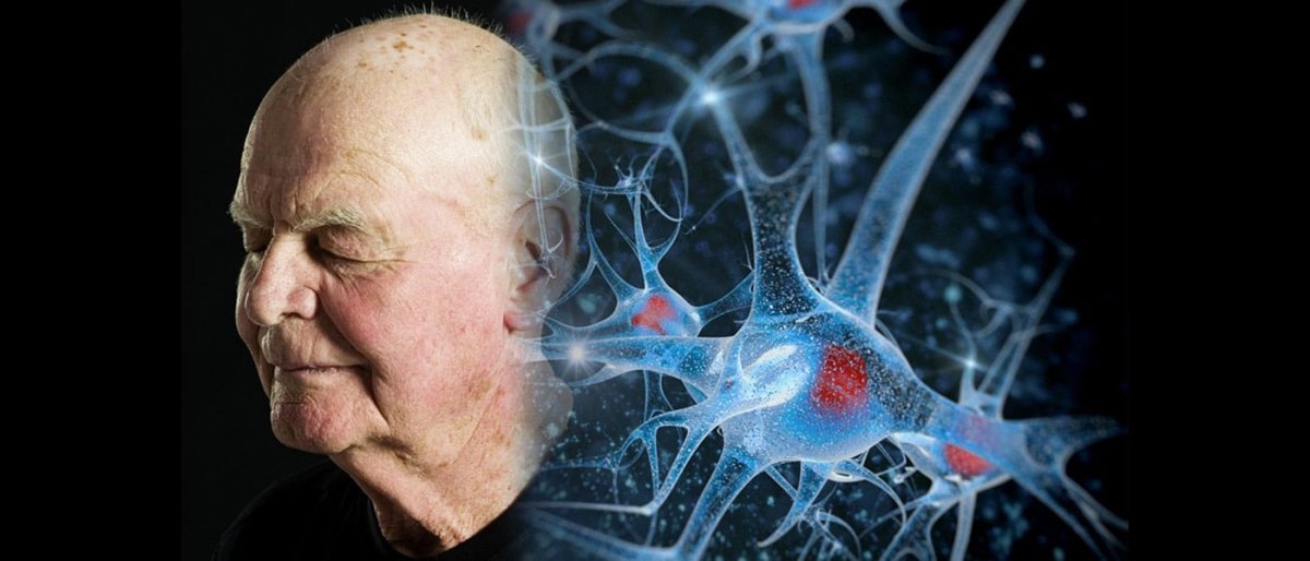 Why Our Brain Cells Die: A Breakthrough in Fighting Neurodegenerative ...