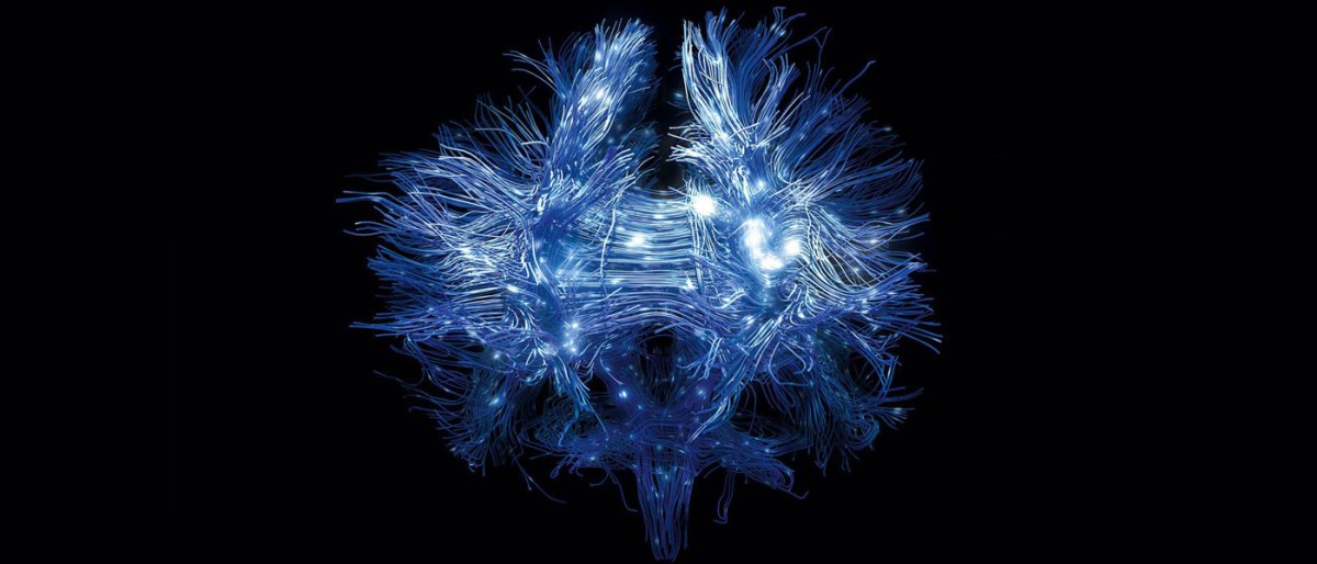 Google's DeepMind AI Now Has a Memory