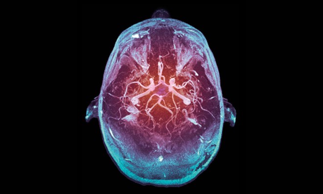 Here's Why Uploading Your Brain to a Computer May Make You Inhuman