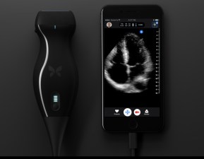 A New Device Lets You Conduct an Ultrasound With a Smartphone