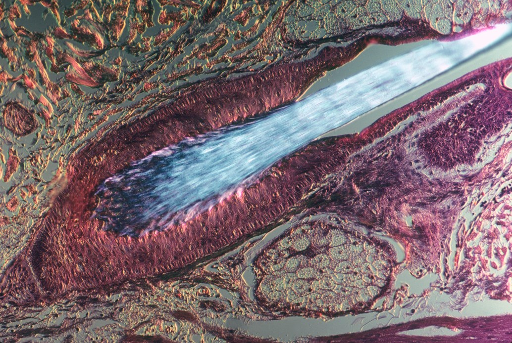 Lab-Grown Skin With Hair Will Illuminate Treatments For Skin Conditions