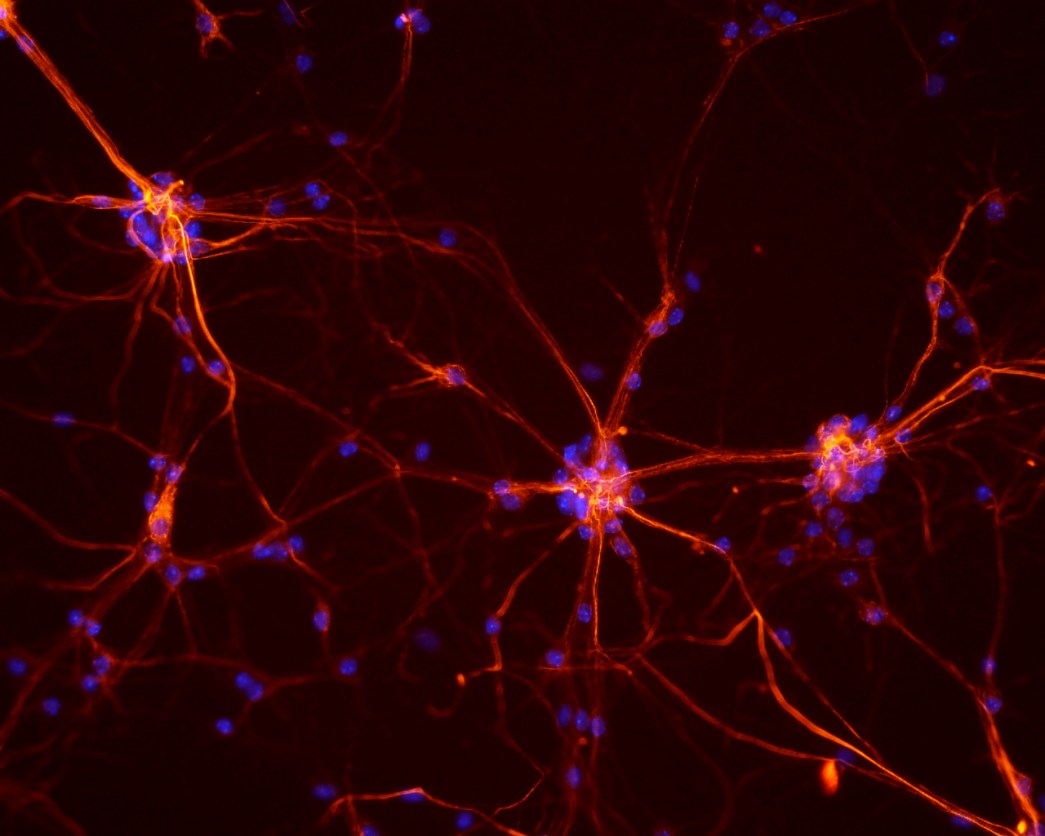 Scientists Identified "Anxiety Cells" in the Brain by Switching Them On ...