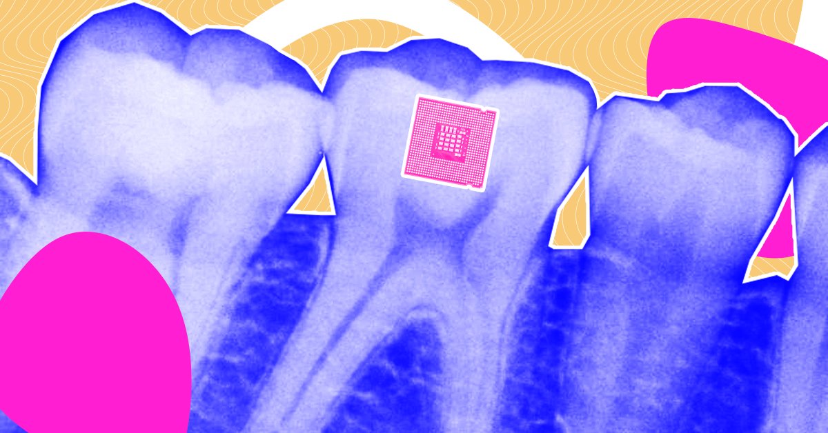 Tooth-Mounted Sensor Could Feed Our Already Unhealthy Relationship With ...