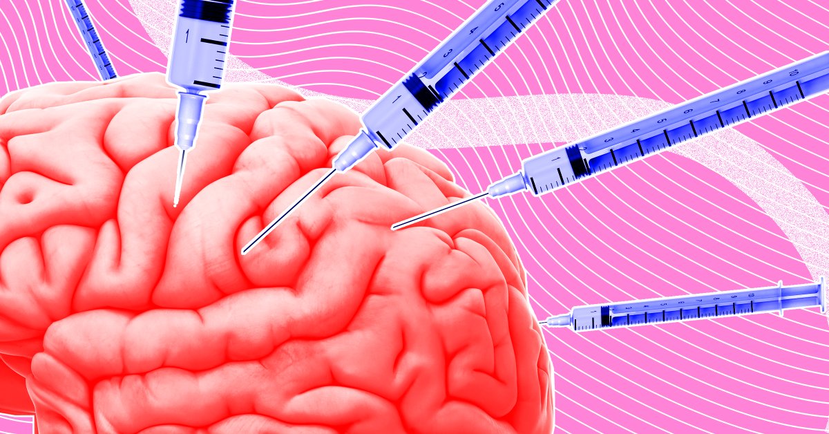 Brain Electrodes Might Be Killing the Cells They're Supposed to Study