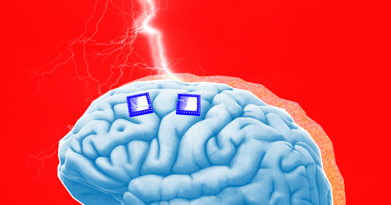 MIT Invents Injectable Brain Chips