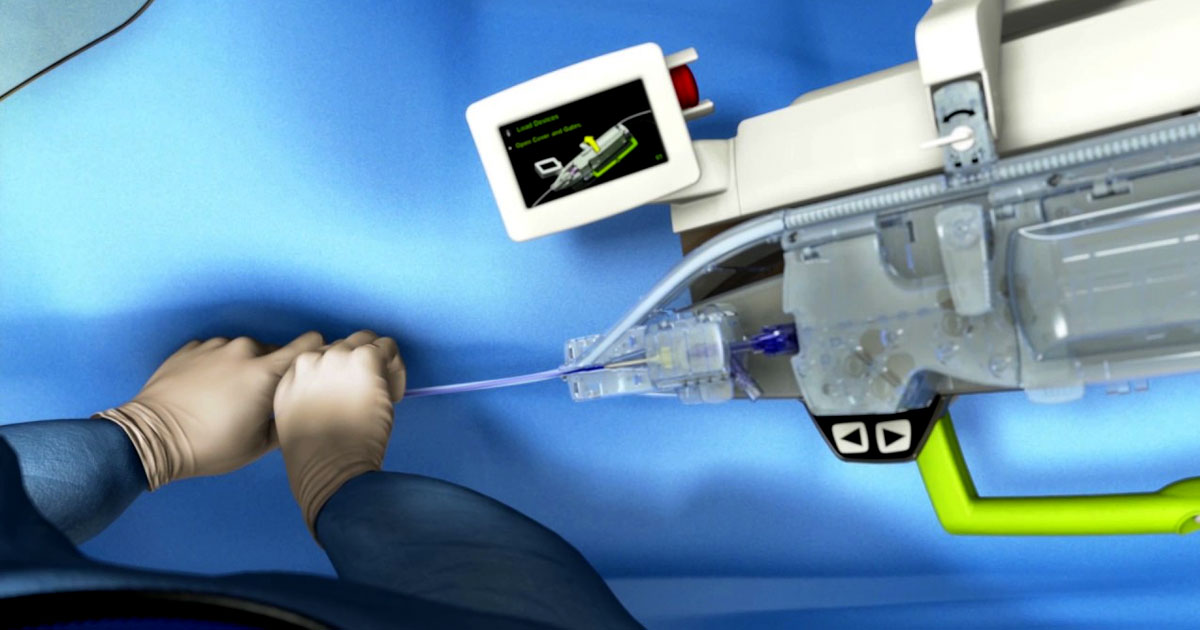 Doctor Uses Robot to Perform First Long-Distance Heart Surgery