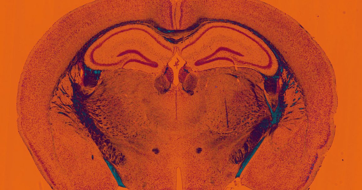 Scientists Keep Brain Tissue From Dead Mice Alive For Weeks