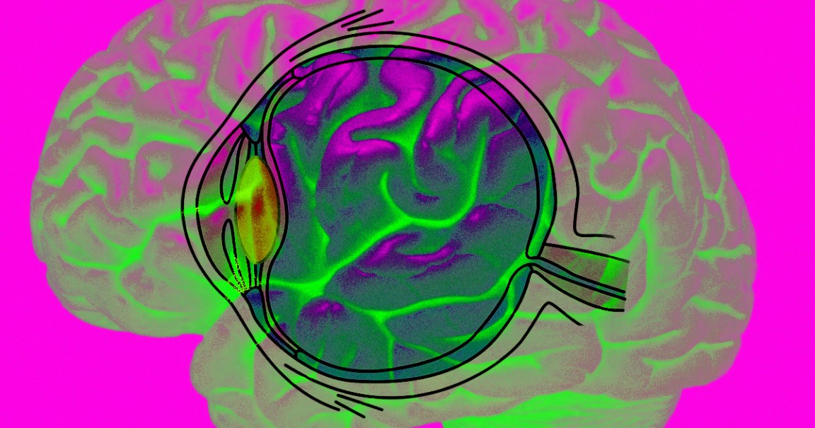 Scientists Plugged a Bionic Eye Directly Into This Woman's Brain
