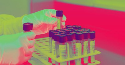 Doctors Find They Can Detect Cancer in Blood Years Before Diagnosis