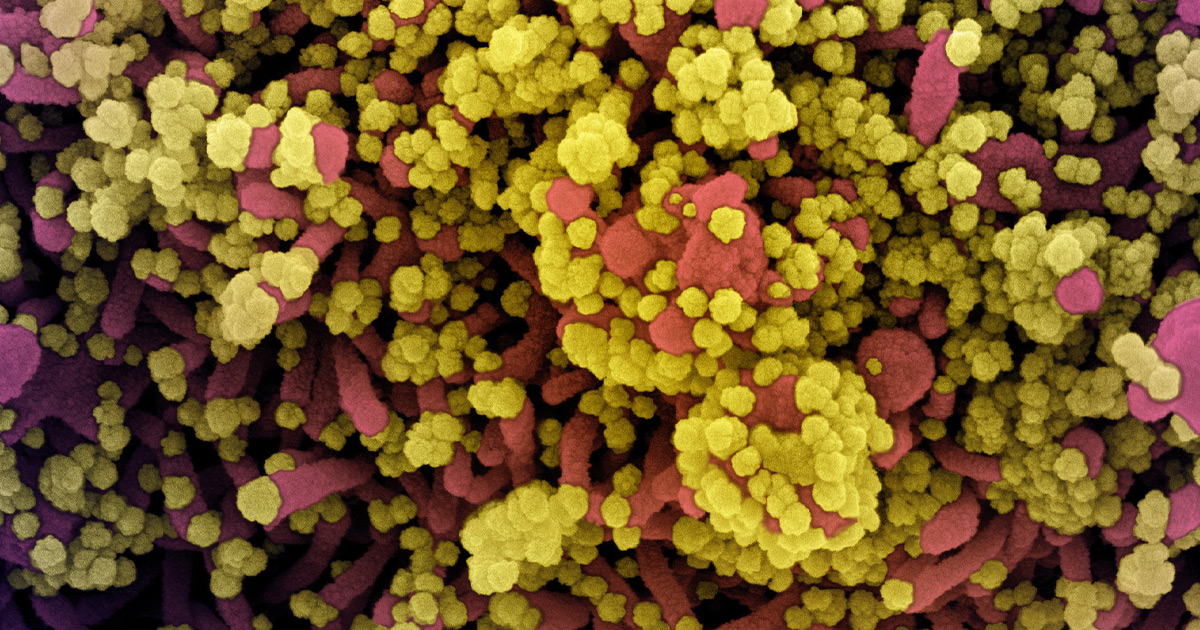 Reinfected Patient's Second Case of COVID-19 Was Even More Severe