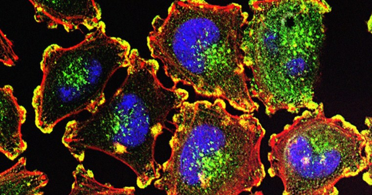 Thousands of Patients to Be Given World's First Cancer Vaccine
