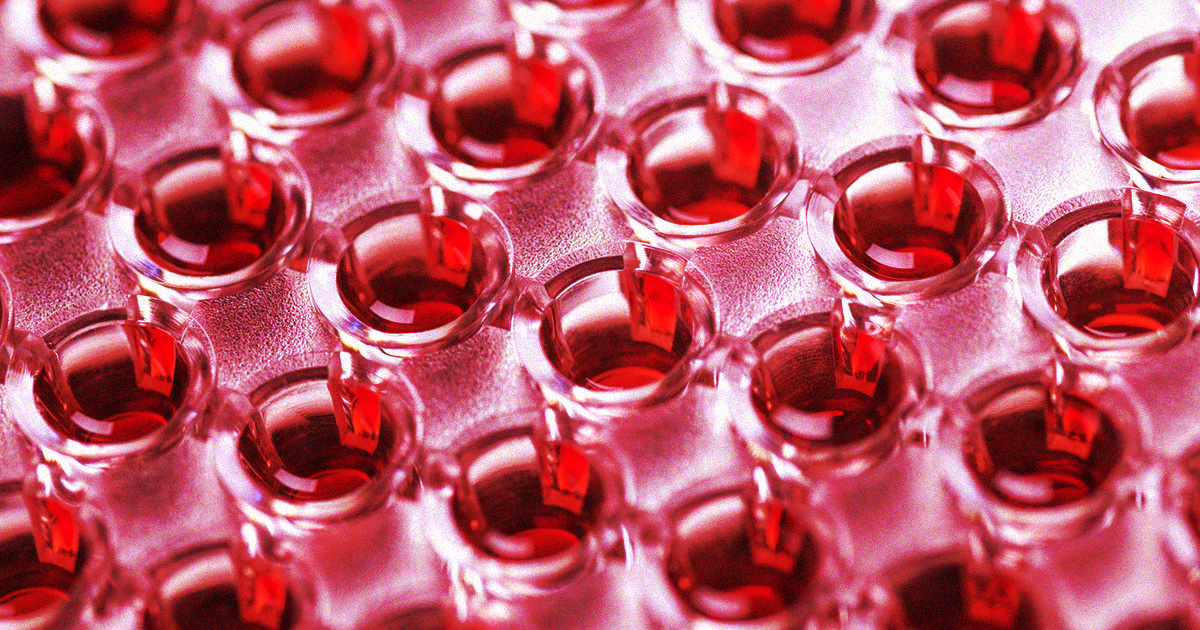Chinese Authorities Are Testing Thousands of Blood Samples From Wuhan