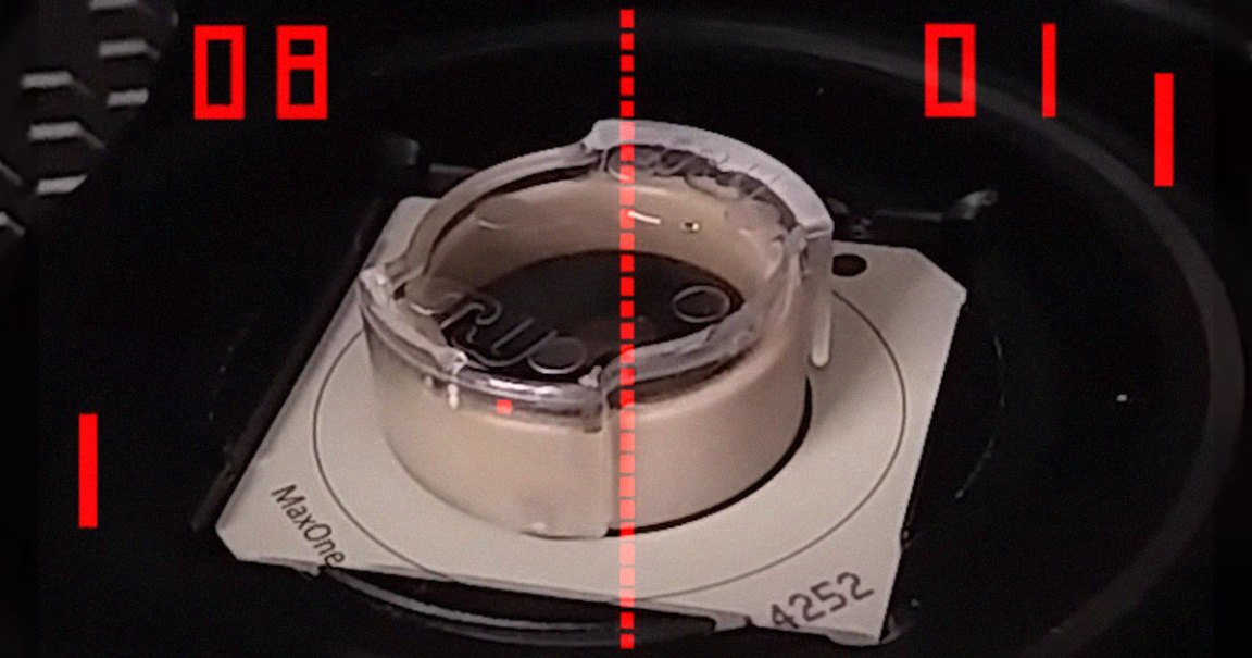 Researchers Teach Human Brain Cells in a Dish to Play "Pong"