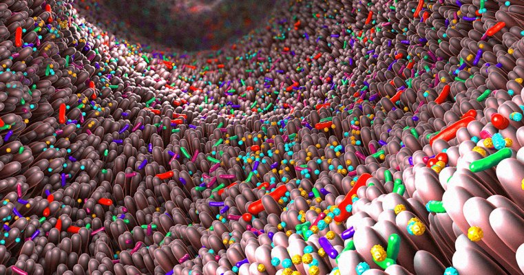 Inflammatory Bowel Disease Linked to Microplastics in Your Gut