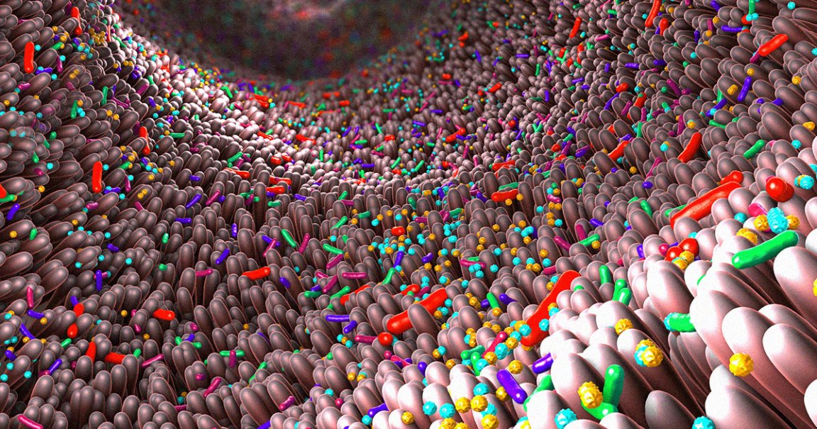 Inflammatory Bowel Disease Linked to Microplastics in Your Gut