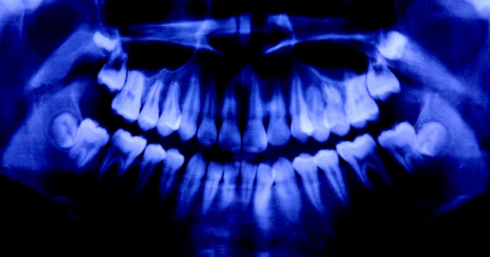 Scientists Just Made Intriguing Progress Toward Regenerating Human Teeth