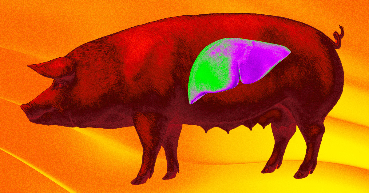 Gene-Hacked Pig Liver Successfully Filters Blood of Human Patient