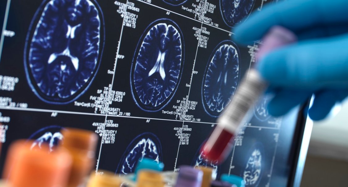As Neuralink Implants Second Subject's Brain, First Patient Says His ...