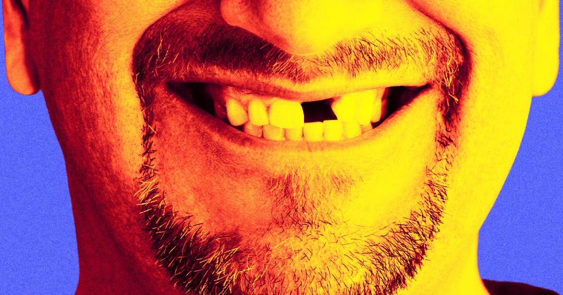 When They Took Fluoride Out of the Water Like RFK Jr. Wants to Do ...