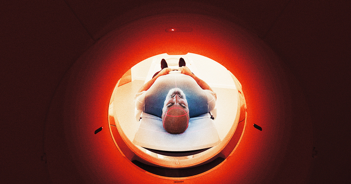 CT Scans Are Causing Quite a Bit of Cancer, Doctors Find