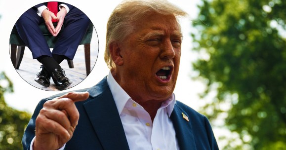 Trump Rages as His Swollen Legs Are Scrutinized